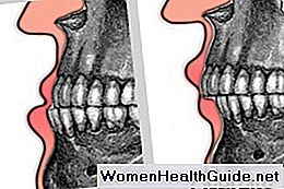 Anatomi Tenggorokan: Bagian Tenggorokan, Gambar 💊 ID.WomenHealthGuide.net