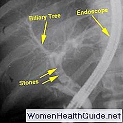 Safra Kesesi Testleri: Ultrason, CT, HIDA Scan, ERCP 💊 TR ...