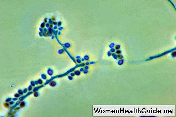 Causas y significado del color del esputo 💊 ES.WomenHealthGuide.net