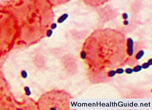 Causas y significado del color del esputo 💊 ES.WomenHealthGuide.net